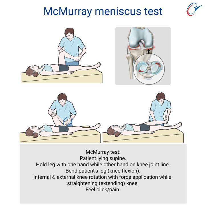Golf Sport Science Injuries - Lower Limb - Knee & Lower Leg - Meniscus ...