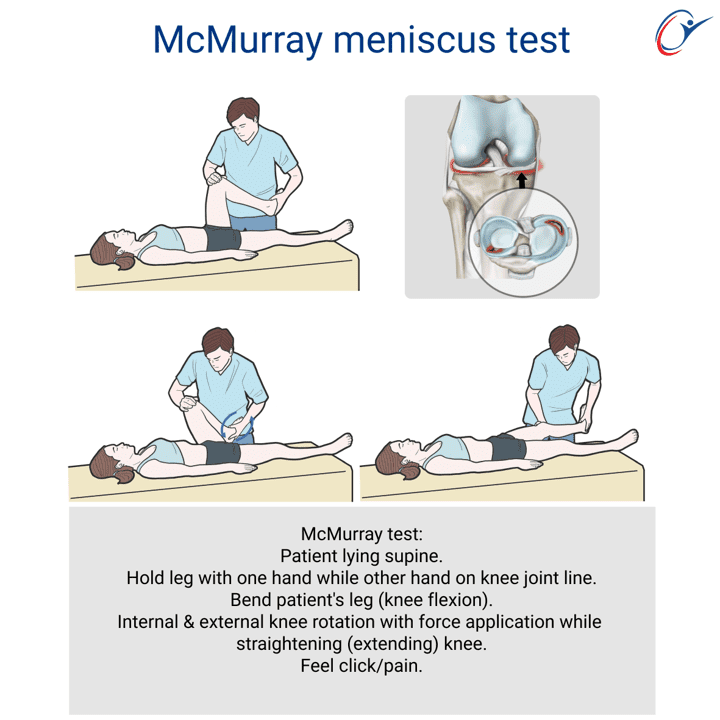 Meniscus Tears In Gymnastics | ASSIC Education